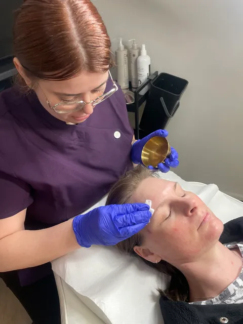 The Velvet Coven: Aesthetics & Teeth Whitening in Gedling, United ...